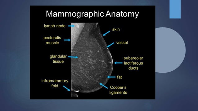 mammographyfull-210721111323 (1).pptx