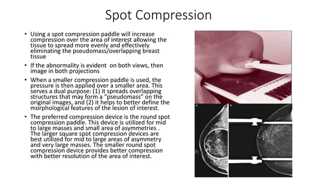 Mammography Positioning Technique for Additional Views | PPTX | Eye and ...