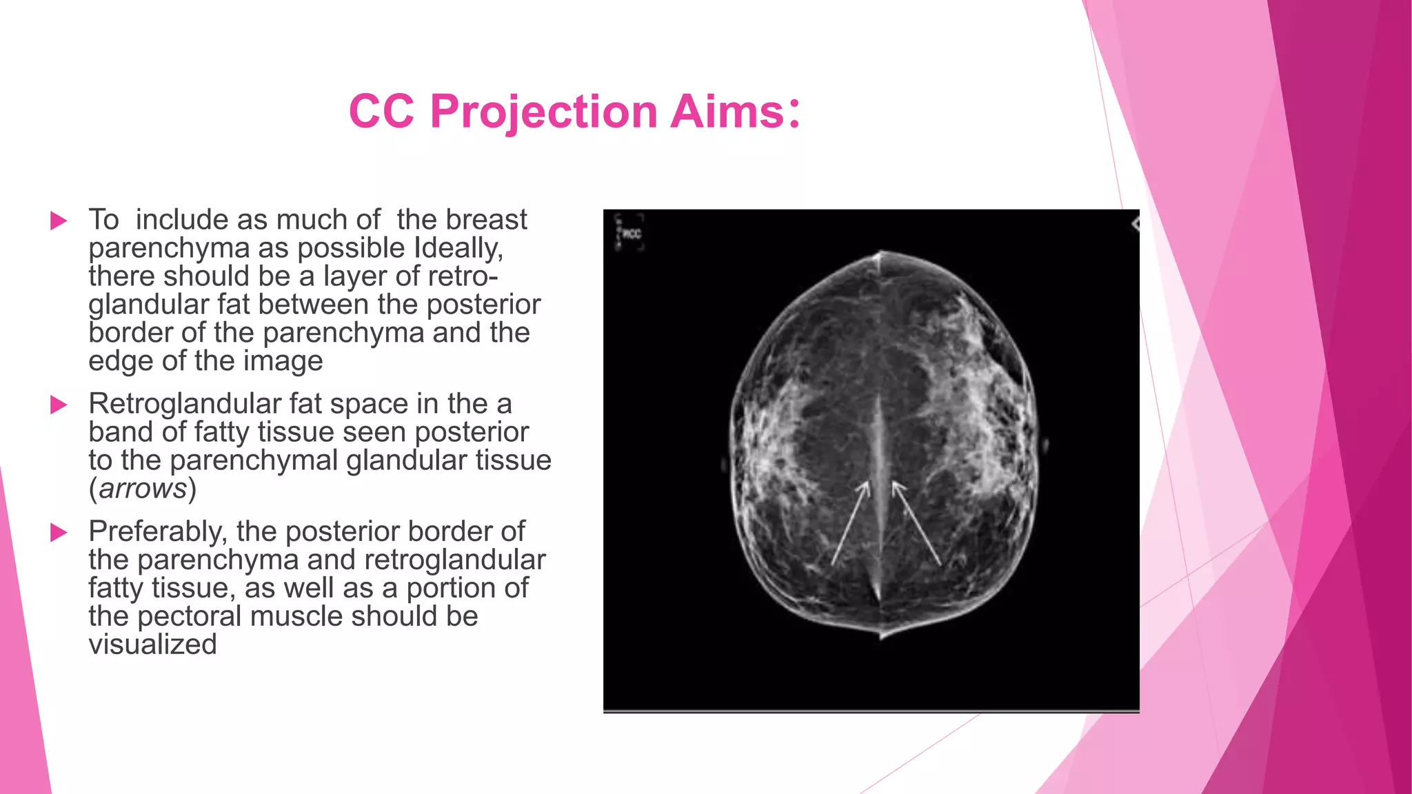 Mammography positioning technique for Cranio Caudal (CC) | PPTX