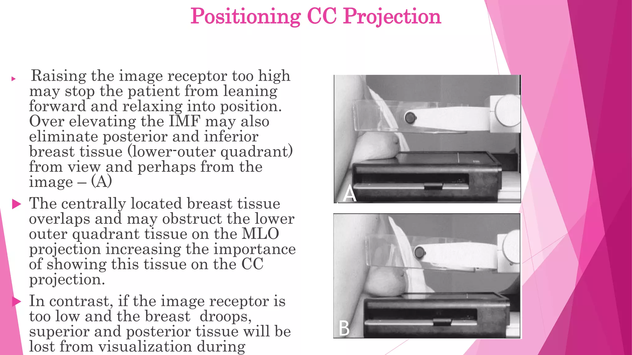 Mammography positioning technique for Cranio Caudal (CC) | PPTX
