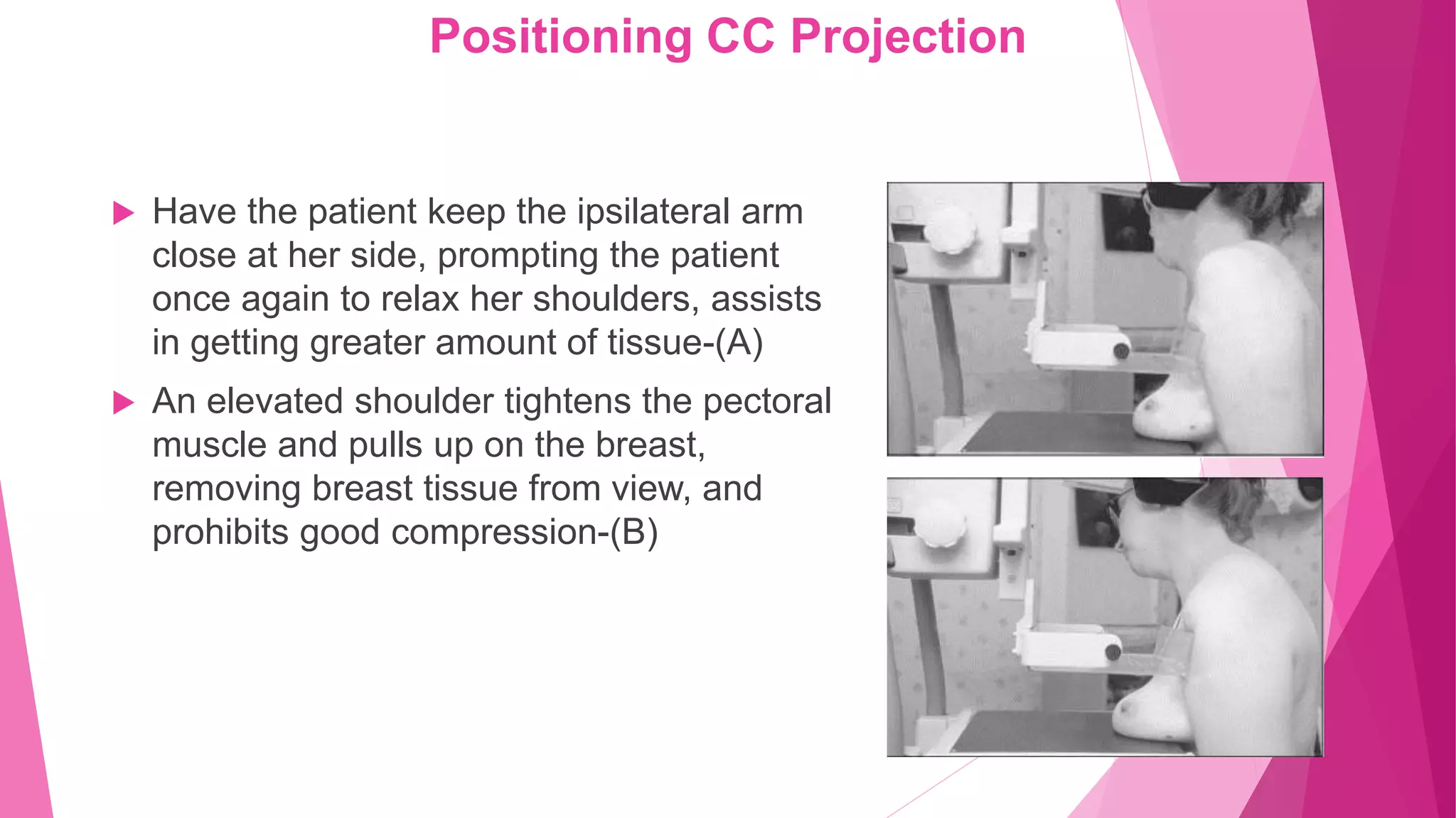 Mammography positioning technique for Cranio Caudal (CC) | PPTX
