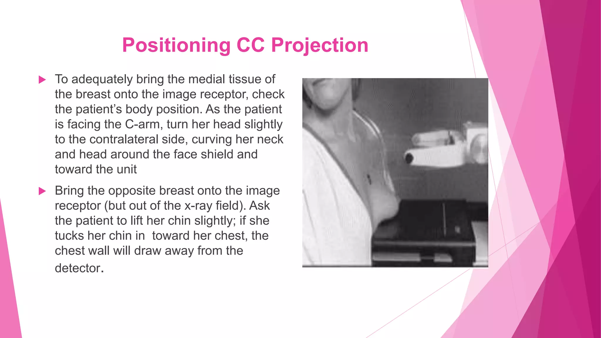 Mammography positioning technique for Cranio Caudal (CC) | PPTX