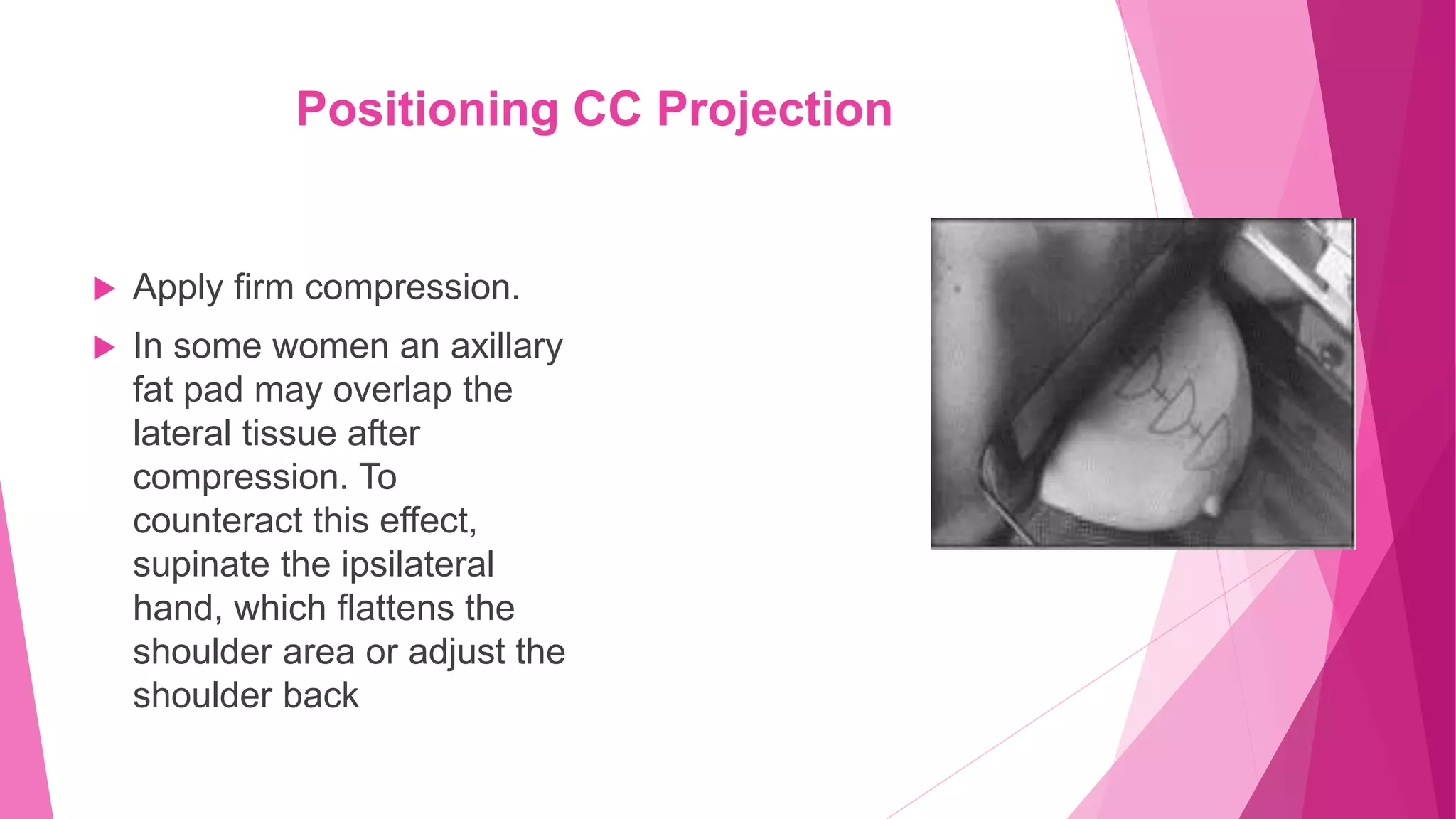 Mammography positioning technique for Cranio Caudal (CC) | PPTX