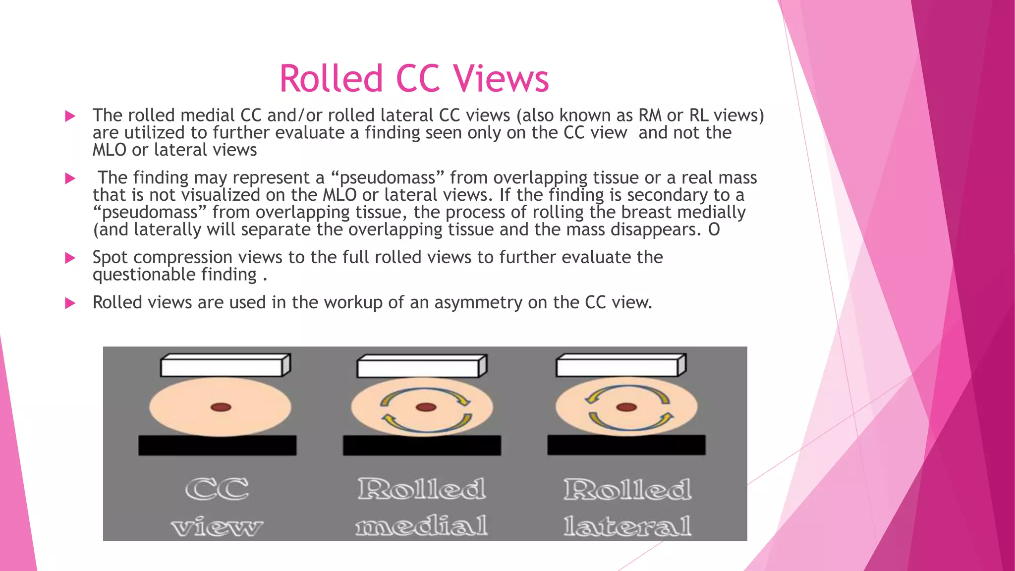 Mammography positioning technique for Cranio Caudal (CC) | PPTX