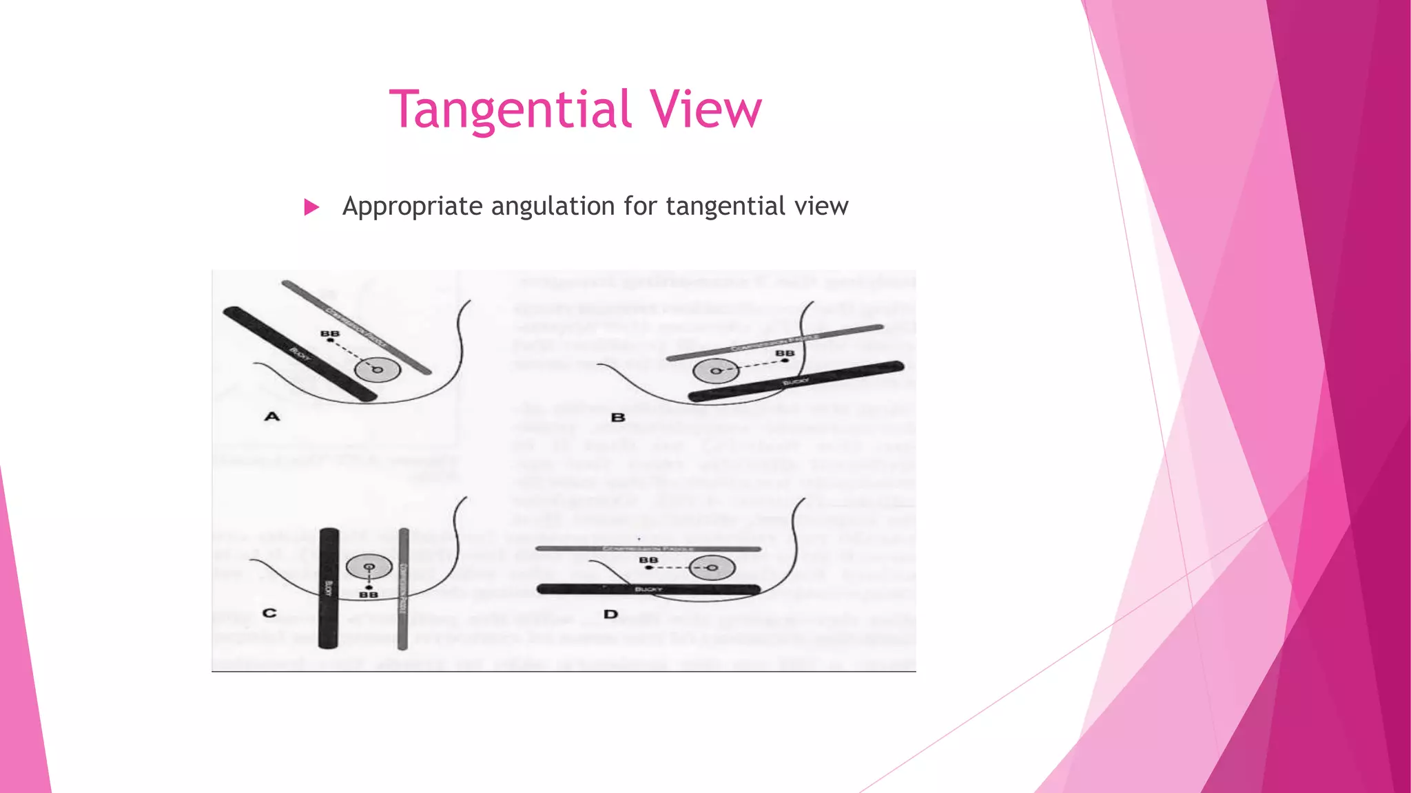 Mammography positioning technique for Cranio Caudal (CC) | PPTX