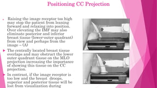 Mammography positioning technique for Cranio Caudal (CC) | PPTX