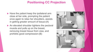 Mammography positioning technique for Cranio Caudal (CC) | PPTX