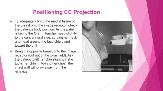 Mammography positioning technique for Cranio Caudal (CC) | PPTX