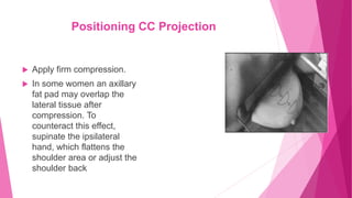 Mammography positioning technique for Cranio Caudal (CC) | PPTX