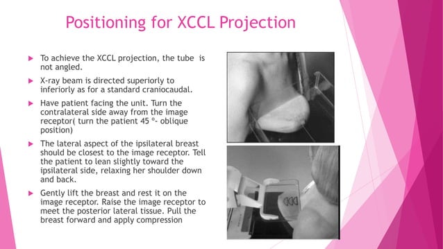 Mammography positioning technique for Cranio Caudal (CC) | PPTX