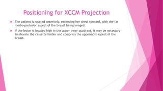 Mammography positioning technique for Cranio Caudal (CC) | PPTX