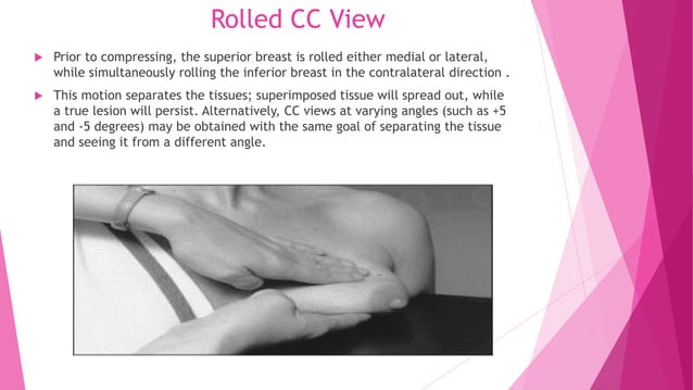 Mammography positioning technique for Cranio Caudal (CC) | PPTX