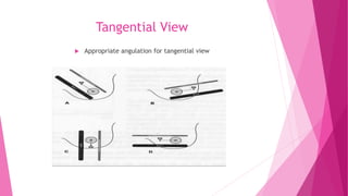 Mammography positioning technique for Cranio Caudal (CC) | PPTX