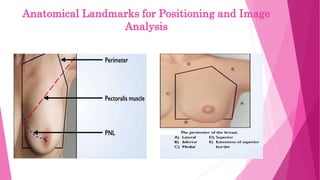Mammography positioning technique for Cranio Caudal (CC) | PPTX