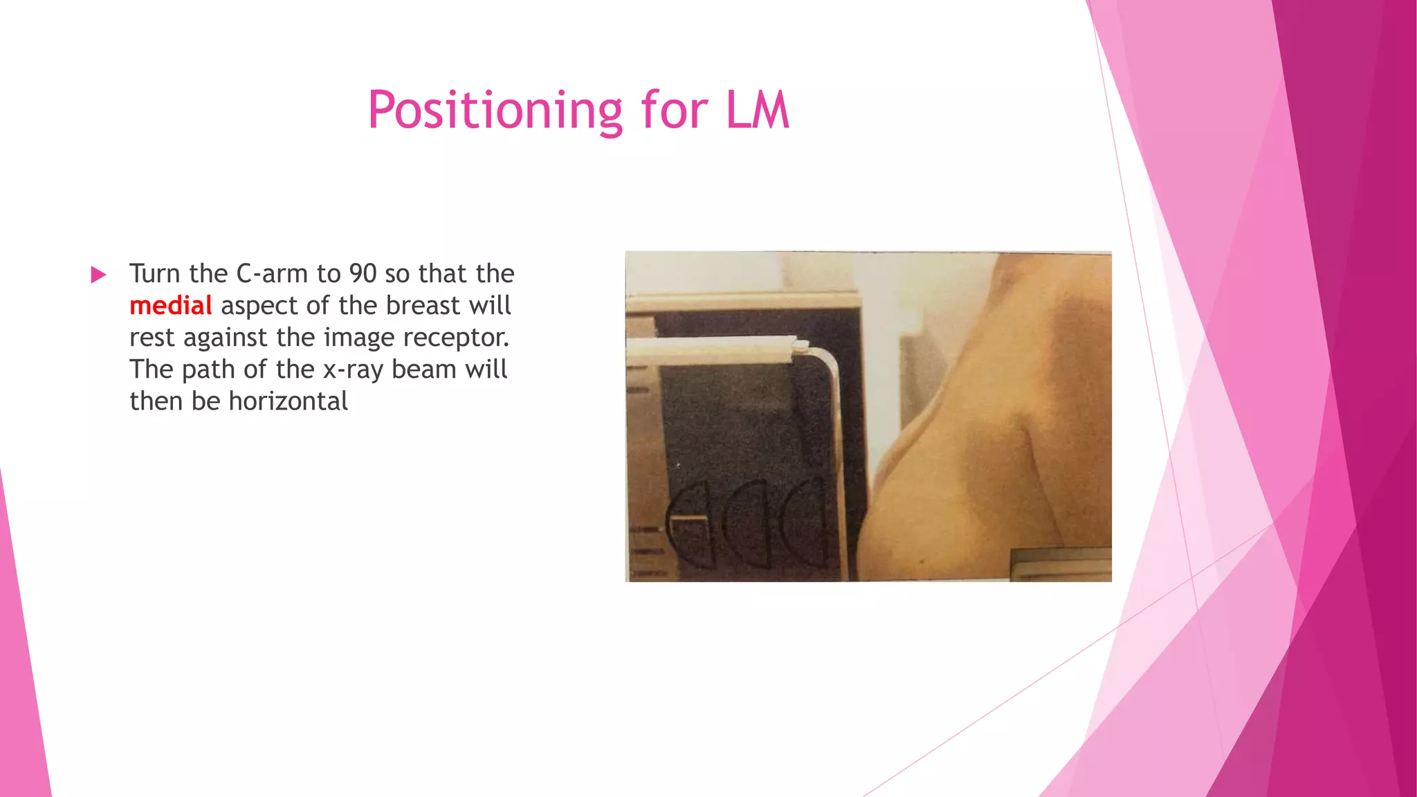 Mammography positioning technique for Lateral Views (LM/ML) | PPTX