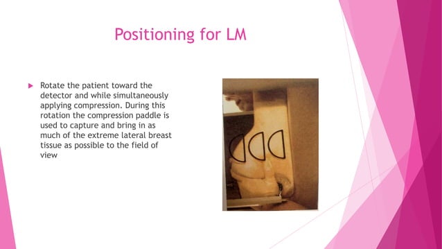 Mammography positioning technique for Lateral Views (LM/ML) | PPTX ...