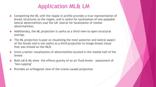 Mammography positioning technique for Lateral Views (LM/ML) | PPTX