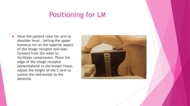 Mammography positioning technique for Lateral Views (LM/ML) | PPTX ...