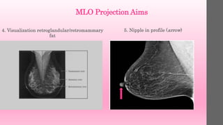 Mammography positioning technique for MLO View | PPTX