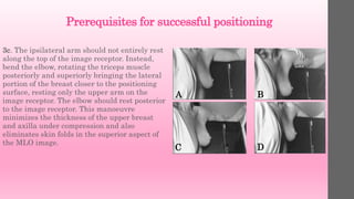 Mammography positioning technique for MLO View | PPTX