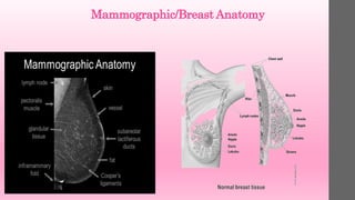 Mammography positioning technique for MLO View | PPTX
