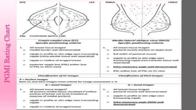 Mammography positioning technique for MLO View | PPTX | Death, Injury ...