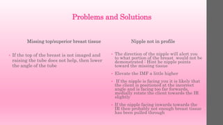 Mammography positioning technique for MLO View | PPTX