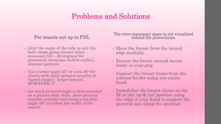 Mammography positioning technique for MLO View | PPTX