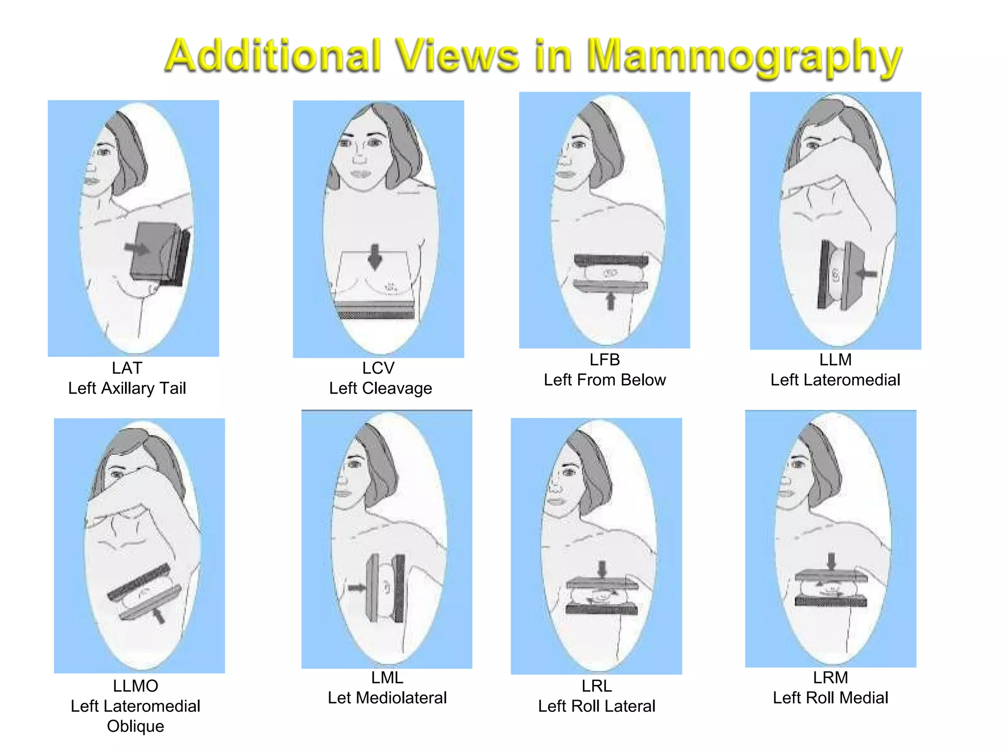Mammography how safe & effective screening tool | PPT