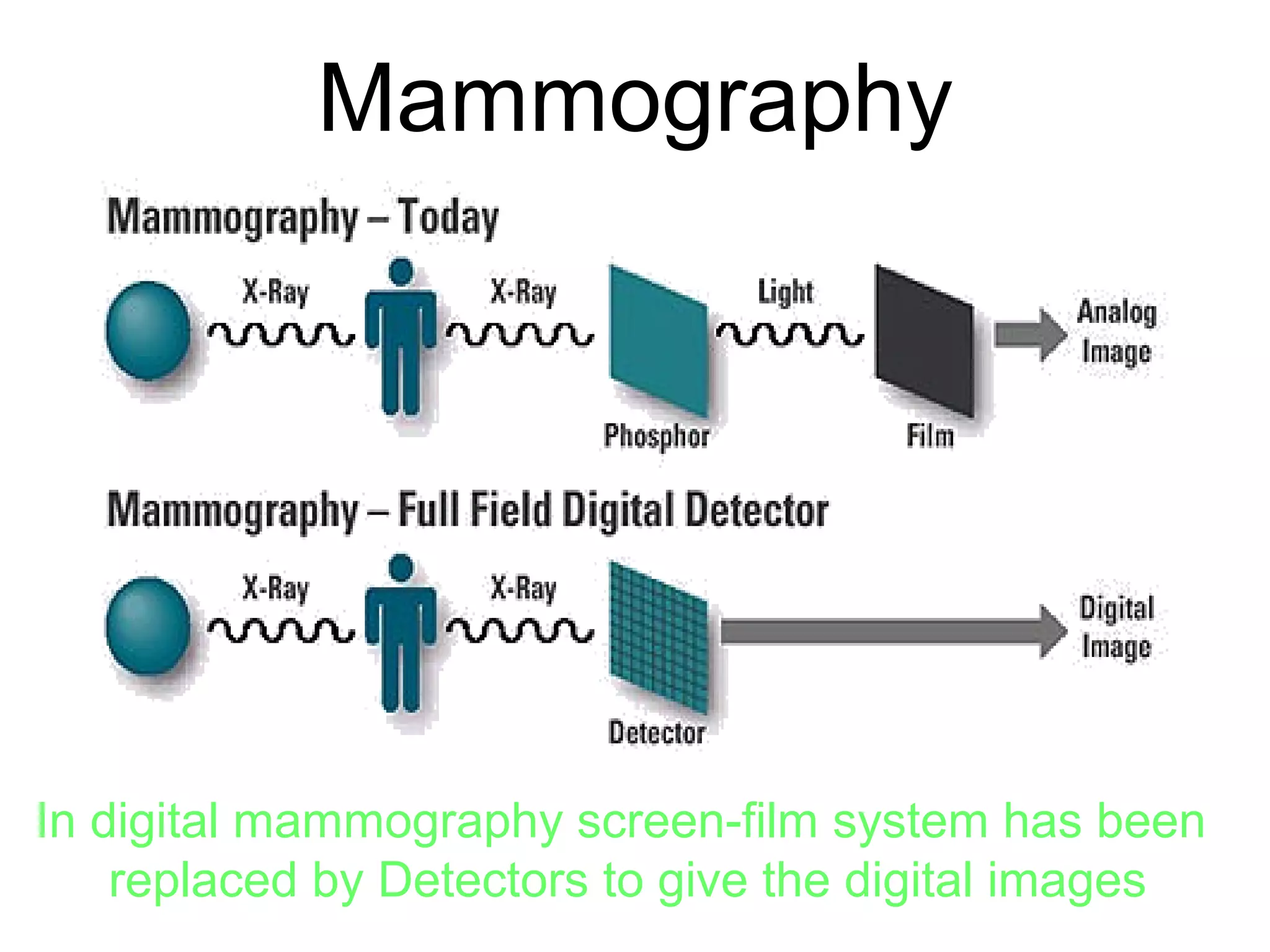 Mammography how safe & effective screening tool | PPT