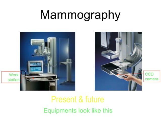 Mammography how safe & effective screening tool | PPT