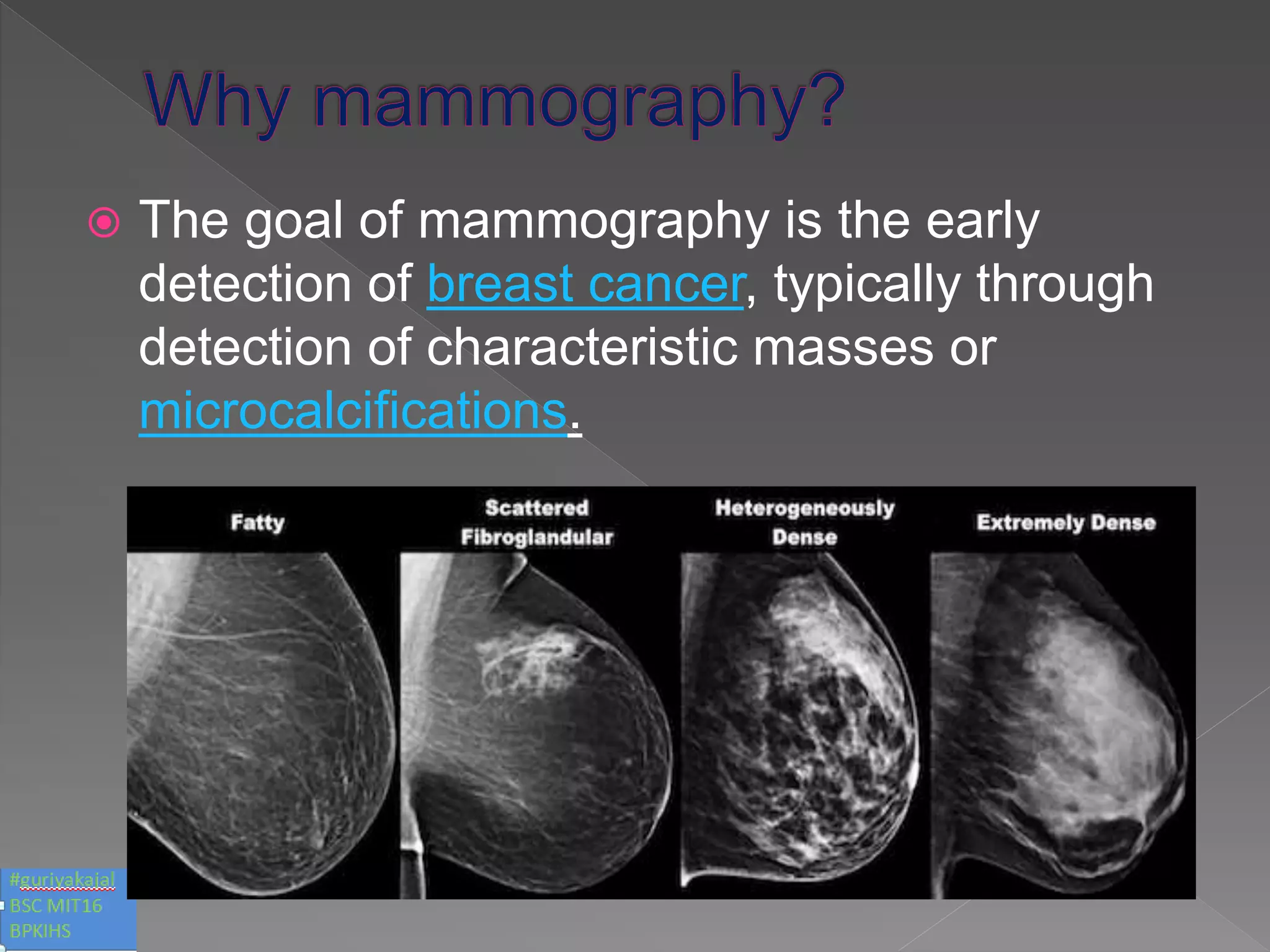 Mammography : quality control (quality assurance) | PPTX