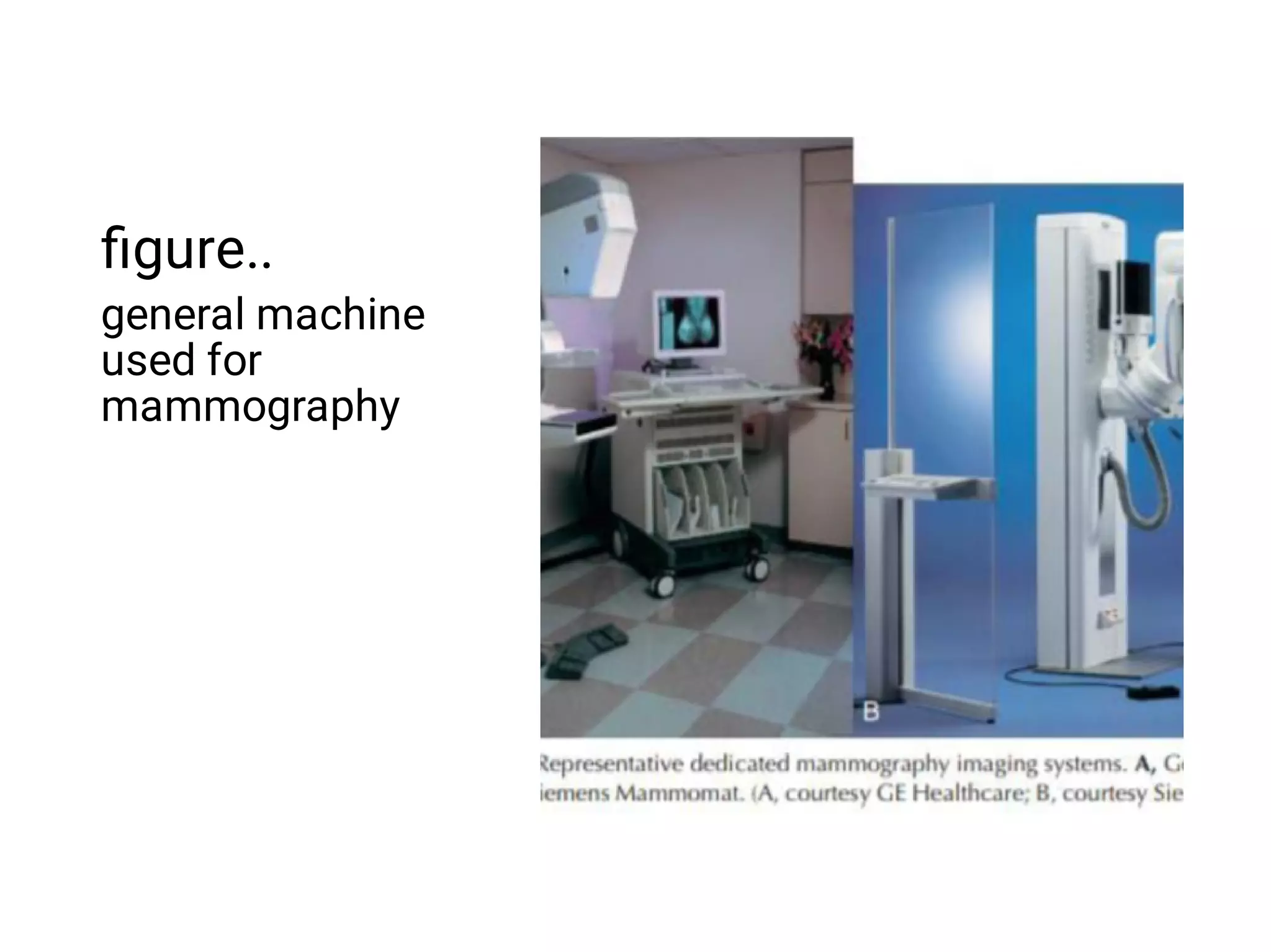 Mammography (Radiology).pdf