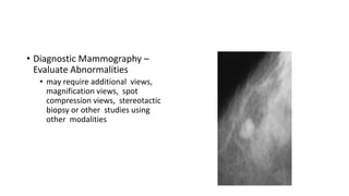 Mammography | PPTX