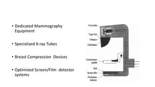 Mammography | PPTX