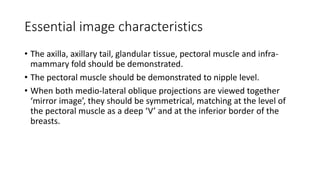 Mammography | PPTX