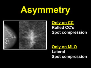 Mammo Guide to the Boards | PPT