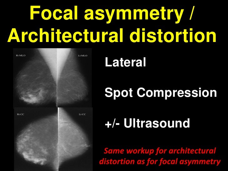 Mammo Guide to the Boards