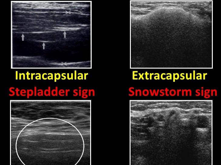 Mammo Guide to the Boards