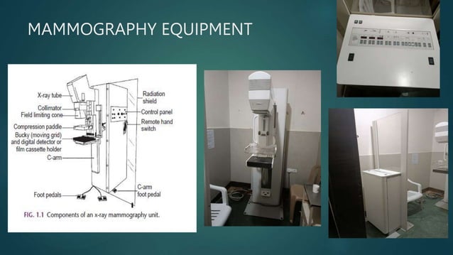 Mammography -A ppt bt J K PATIL, Prof,dept of radiology | PPTX