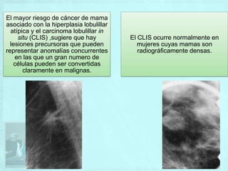 Mamografía de la mama normal | PPTX