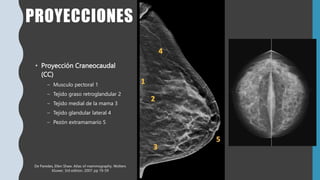 MAMOGRAFIA.pptx