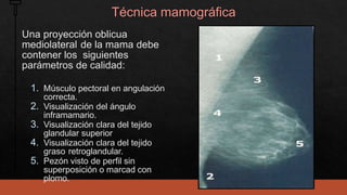 MAMOGRAFIA NORMAL.pptx