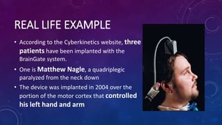 Braingate by Mamta | PPT