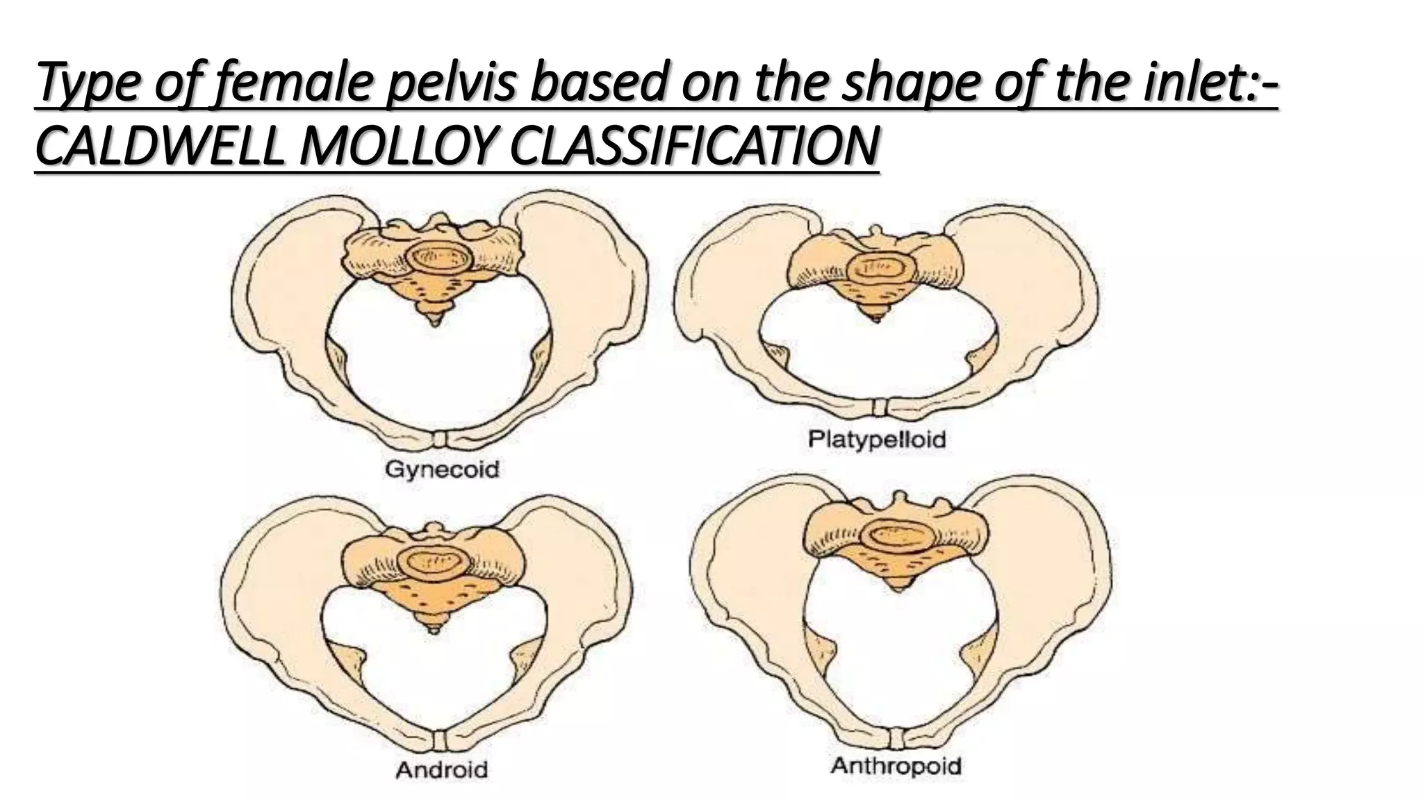 Contracted pelvis | PPTX