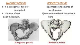 Contracted pelvis | PPTX