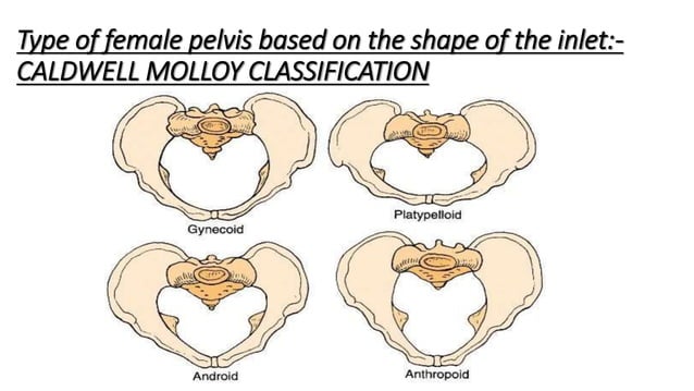 Contracted pelvis | PPTX | Pregnancy | Reproductive Health