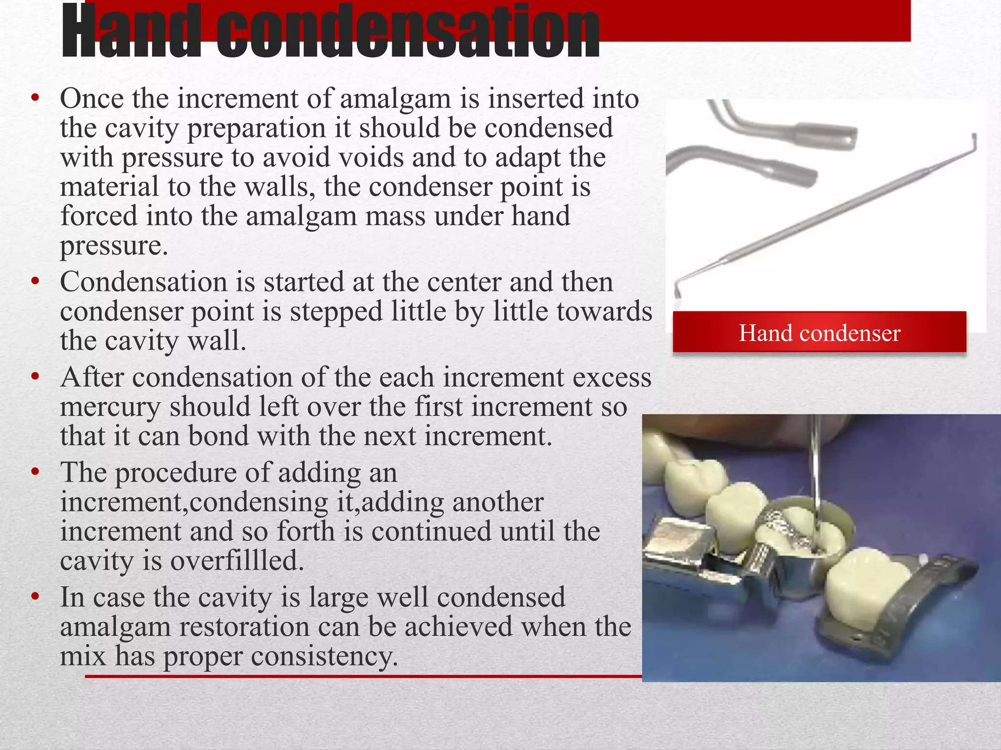 procedure for amalgam restoration | PPTX