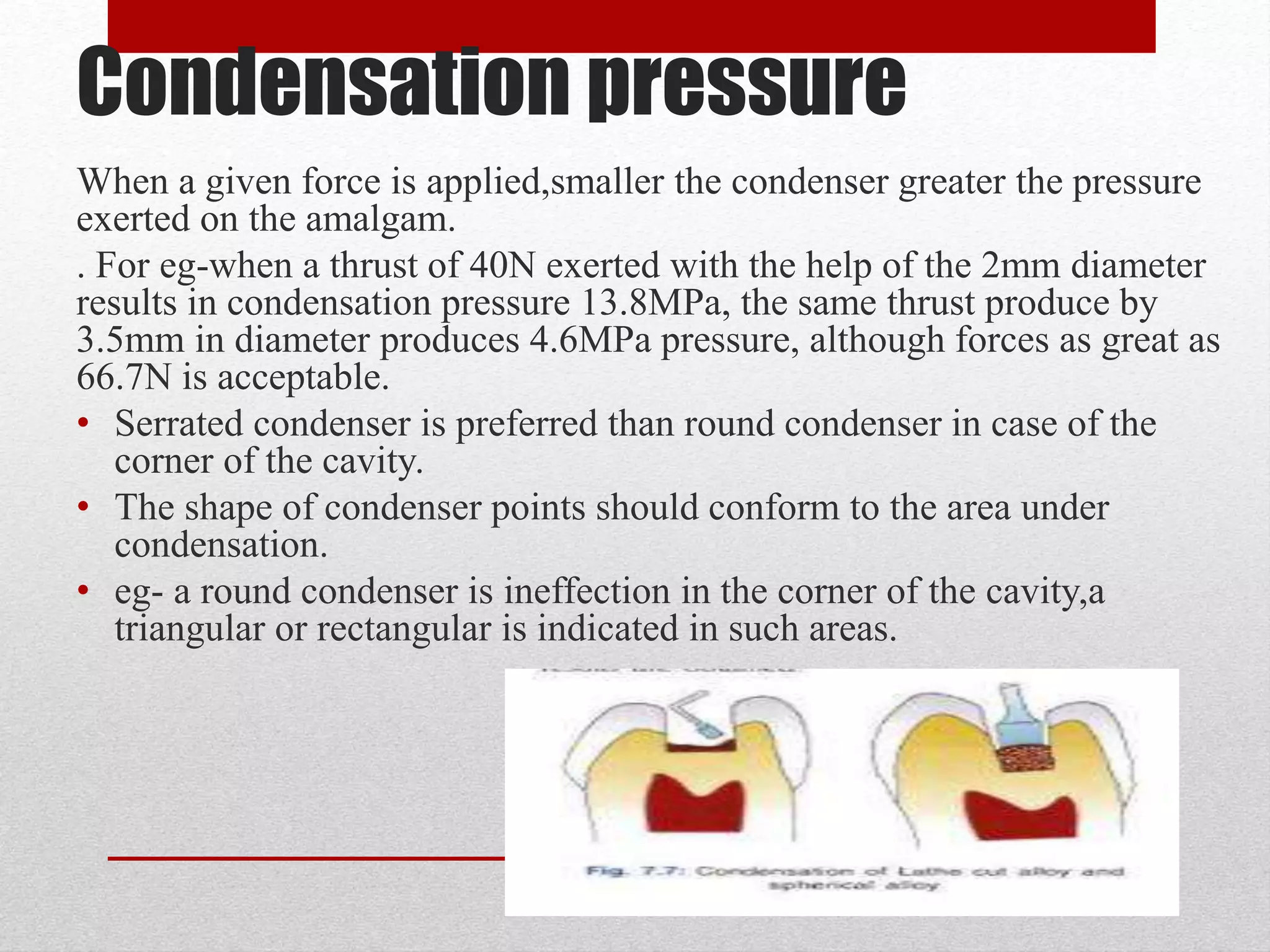 procedure for amalgam restoration | PPTX