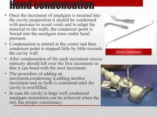 procedure for amalgam restoration | PPTX
